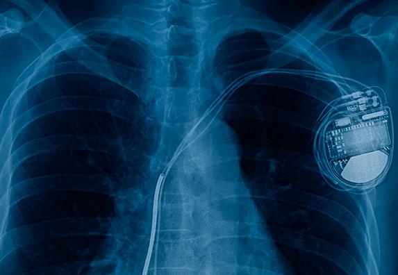 Medical Applications | TTM Technologies